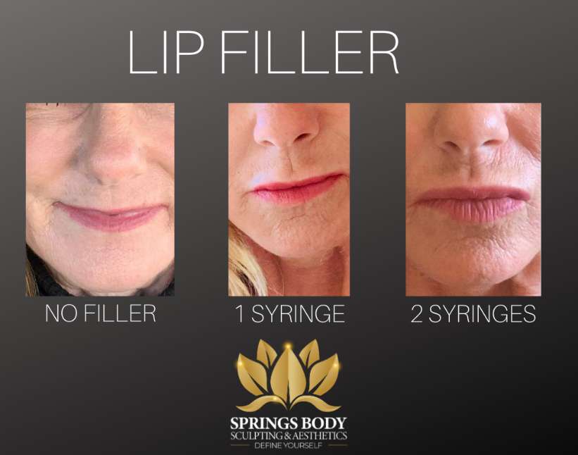 Colorado Springs Premier Med Spa | Springs Body Sculpting